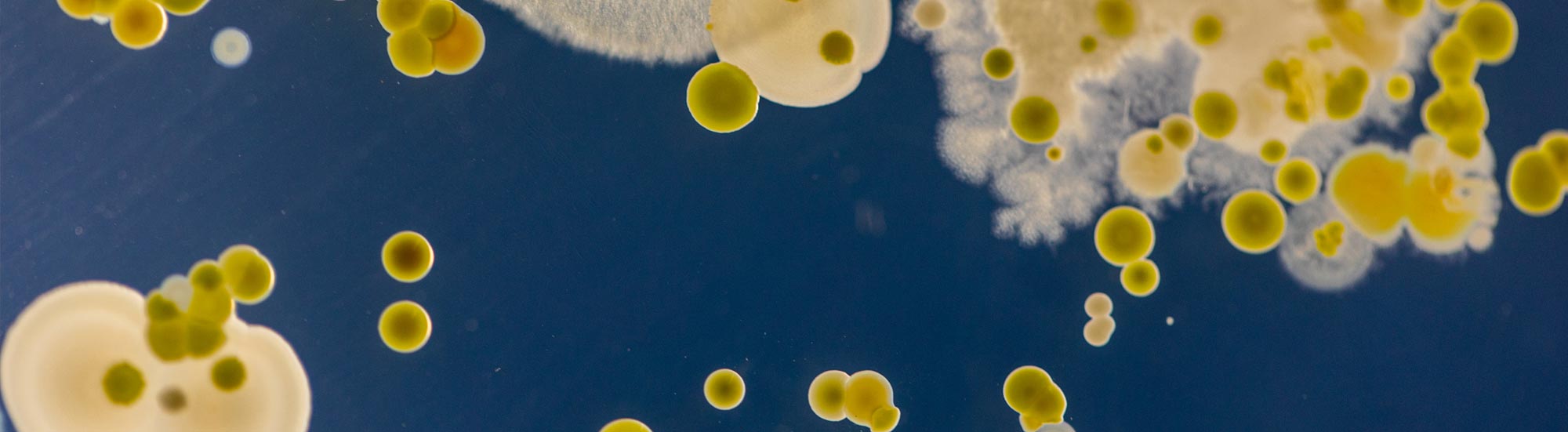 Chronic Disease, Inflammation, and The Microbiome - Microbiome Alliance ...